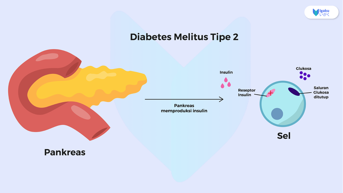 Hubungan Antara Diabetes Melitus dan Genetik - IGAKU Hubungan Antara Diabetes Melitus dan Genetik - IGAKU